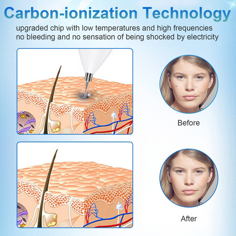 Badu Bg Надстройте писалката за премахване на бенки Преносима писалка за премахване на етикети