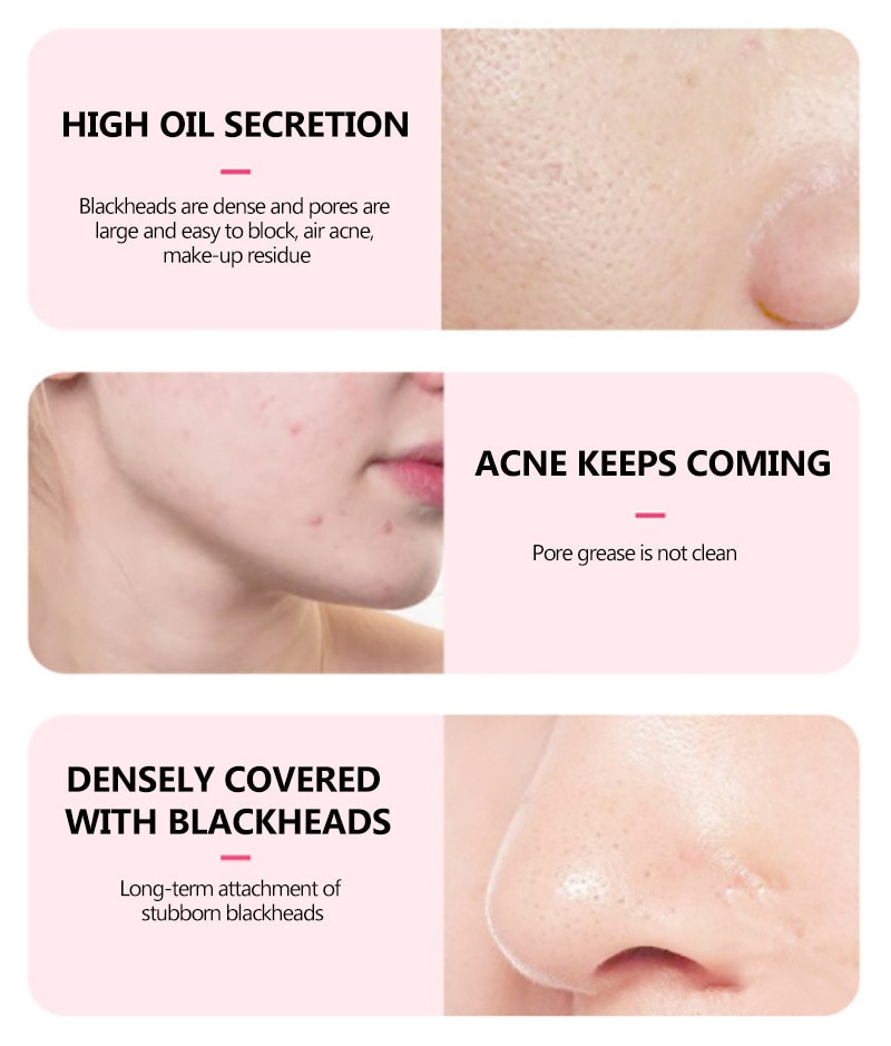 Badu Bg Система за почистване със силиконов гел Ултразвукова