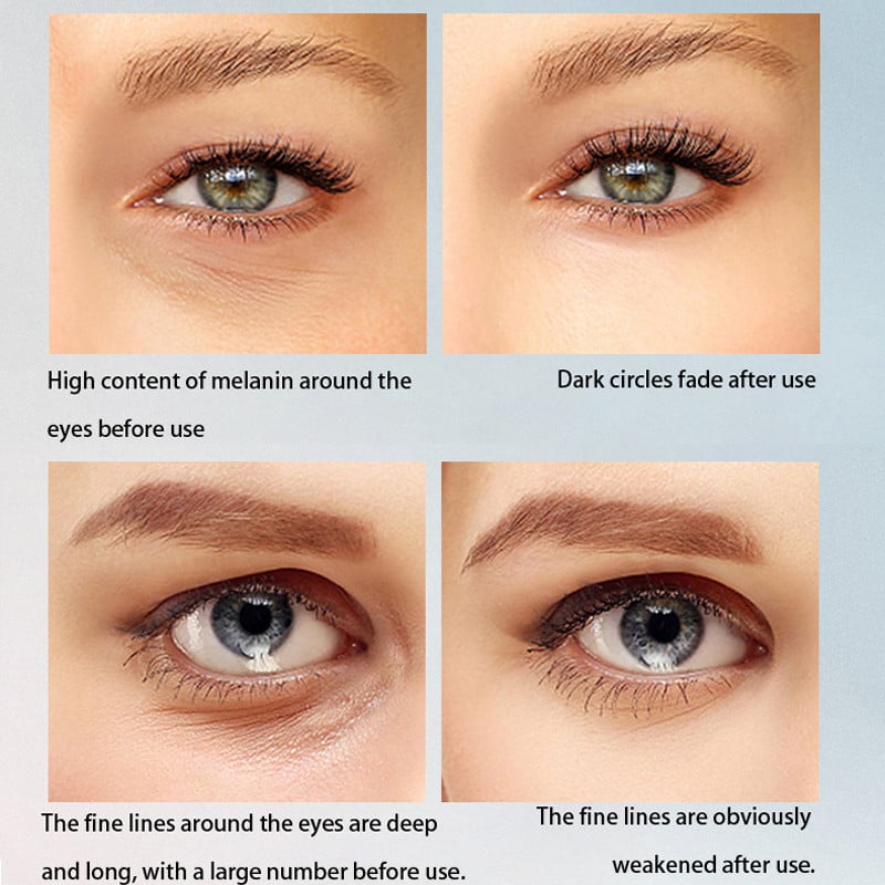 Badu.bg RF масажор за очи против подпухналост Eyes Lifting Beauty ...