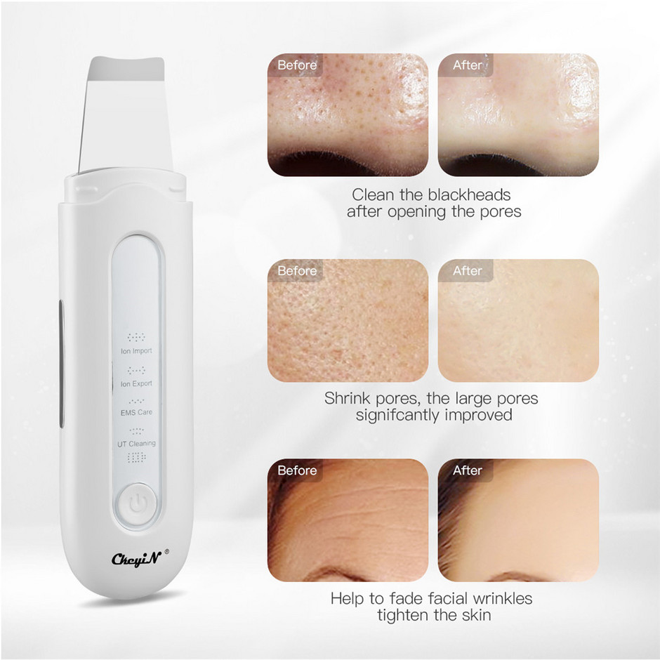 Badu.bg CkeyiN EMS Microcurrent Sonic Skin Scrubber Ultrasonic Comedone Extractor Acne Blackhead ...